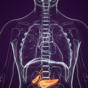 Enfermedades de la Vesícula Biliar - Gastroenterologo Ciudad de Mexico